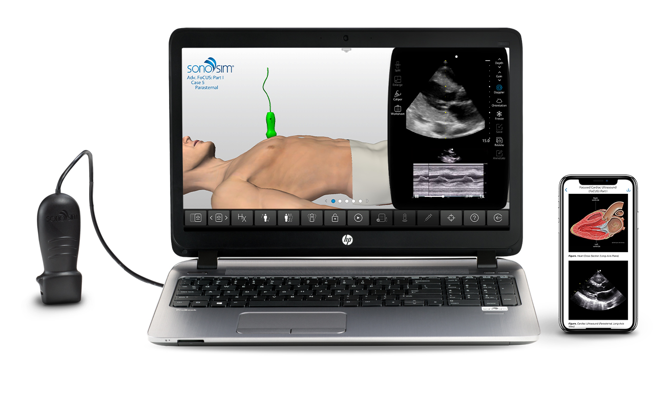 SonoSim Ultrasound Training Technology - System Requirements